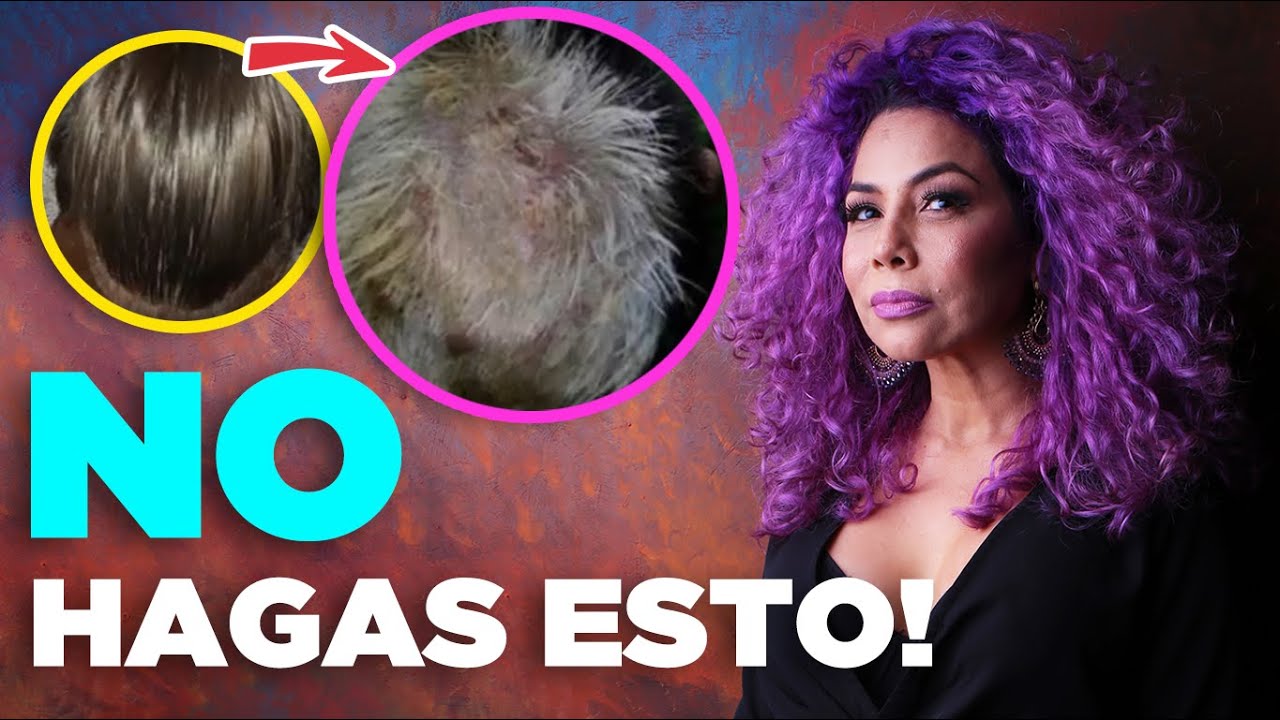Descubre cómo reparar el cuero cabelludo quemado en 5 minutos 【 2025